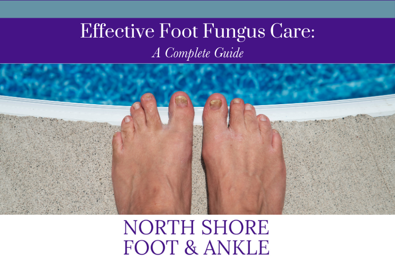 Effective Foot Fungus Care:A Complete Guide in New York | North Shore ...