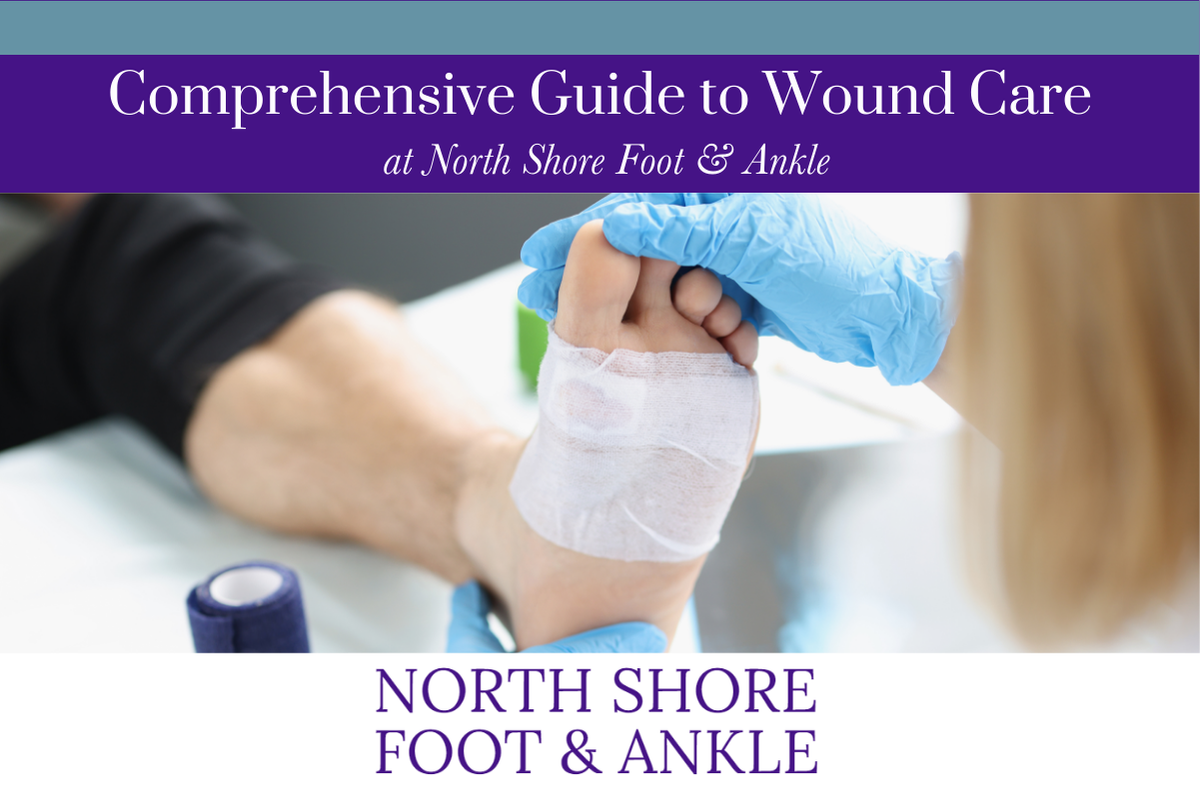 Comprehensive Guide to Wound Care at North Shore Foot & Ankle | North ...
